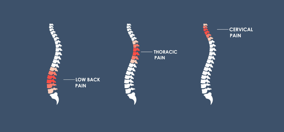 Chiropractic Care – Chiropractor in Suwanee GA – Integrity Spine & Wellness